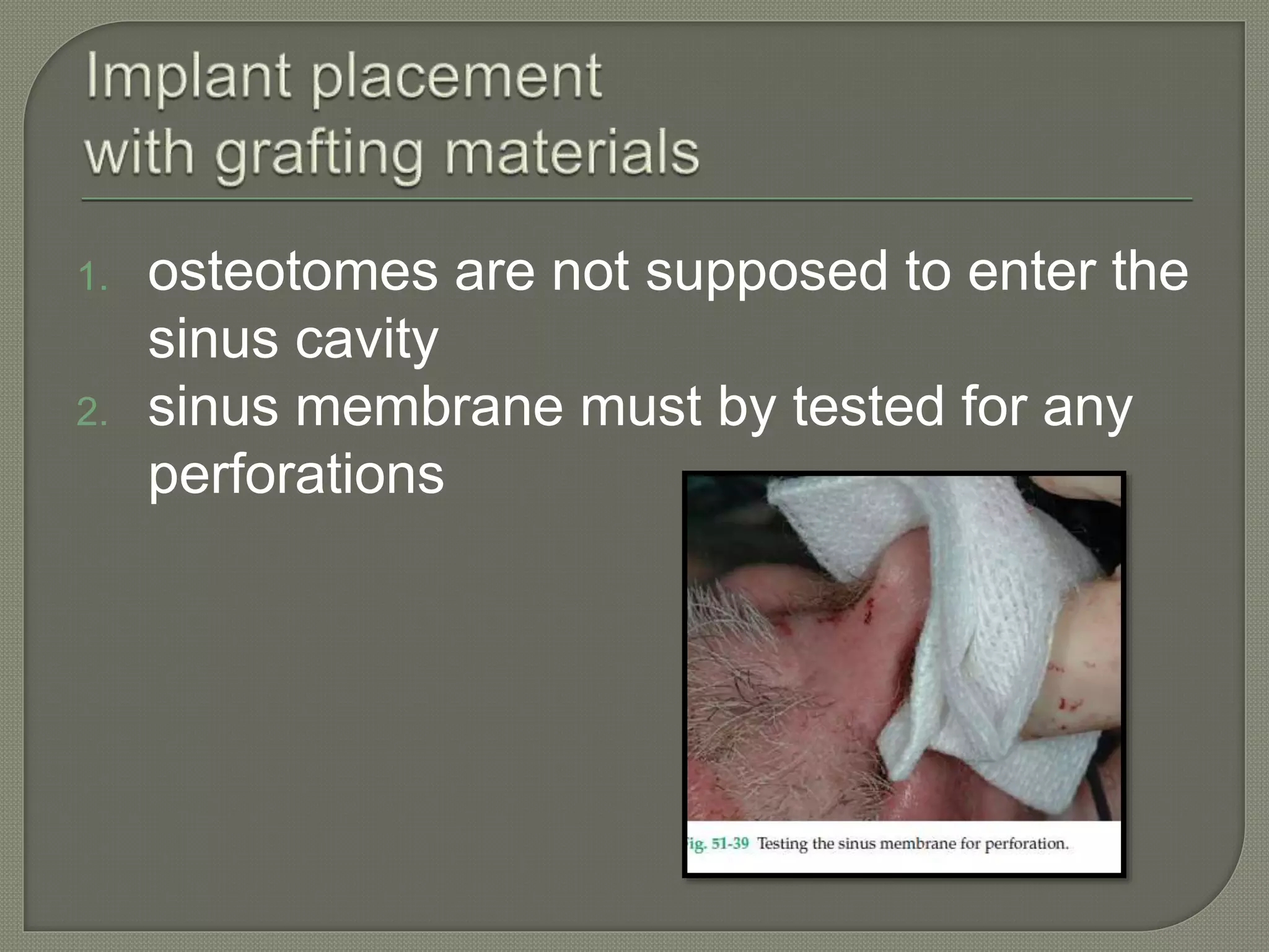 Closed Sinus Lift Surgery | PPTX