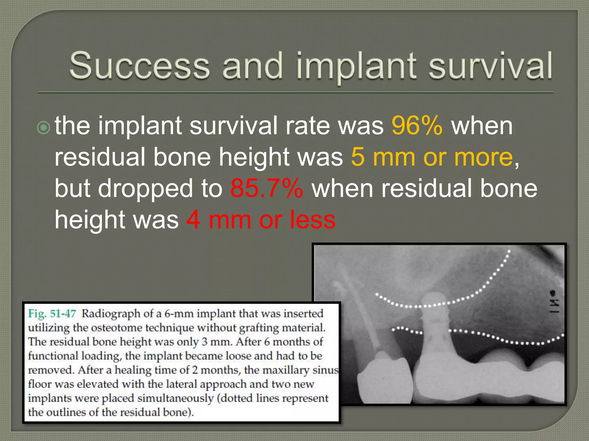 Closed Sinus Lift Surgery | PPTX