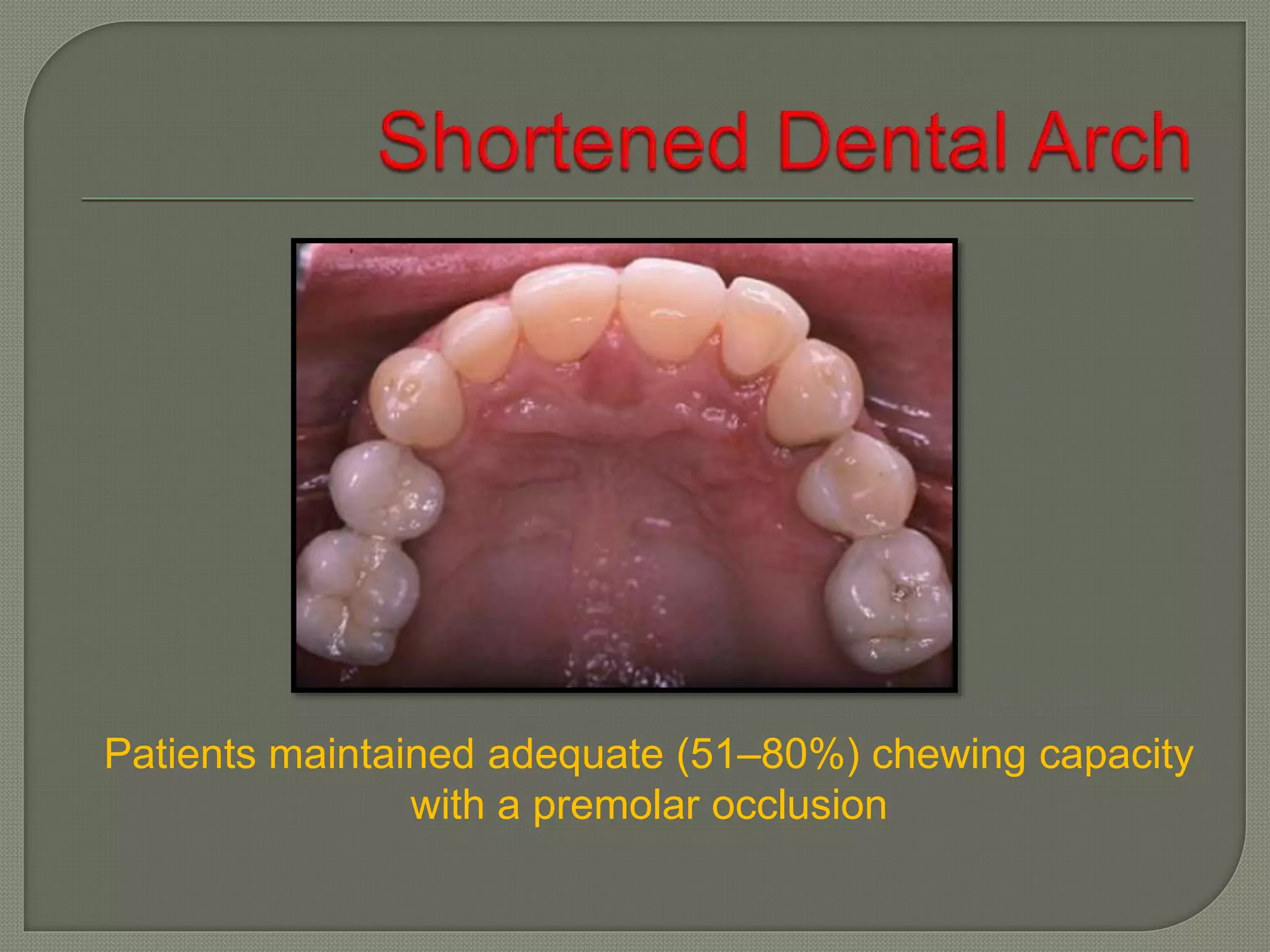 Closed Sinus Lift Surgery | PPTX
