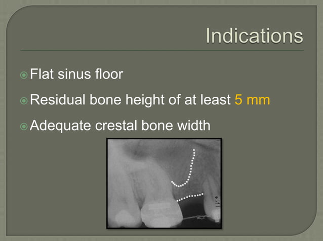 Closed Sinus Lift Surgery | PPTX