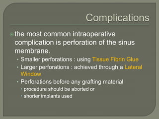 Closed Sinus Lift Surgery | PPTX