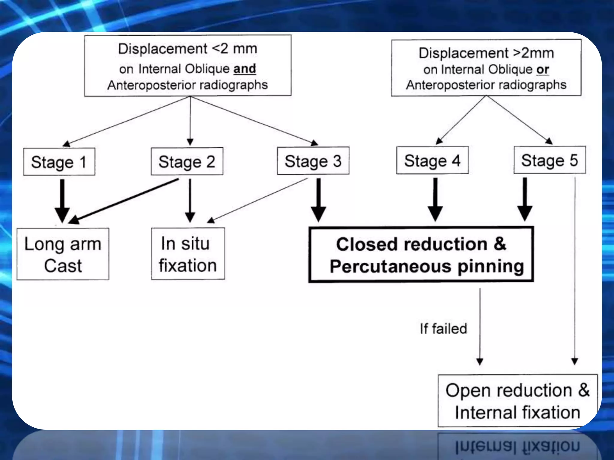 Closed vs. open reduction in lateral condylar fractures of humerus in ...