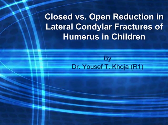 Closed vs. open reduction in lateral condylar fractures of humerus in ...