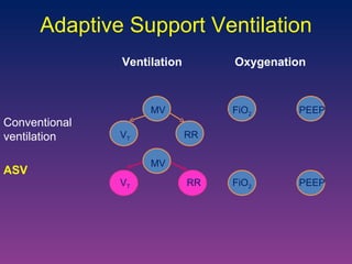 Close loop Ventilation | PPT