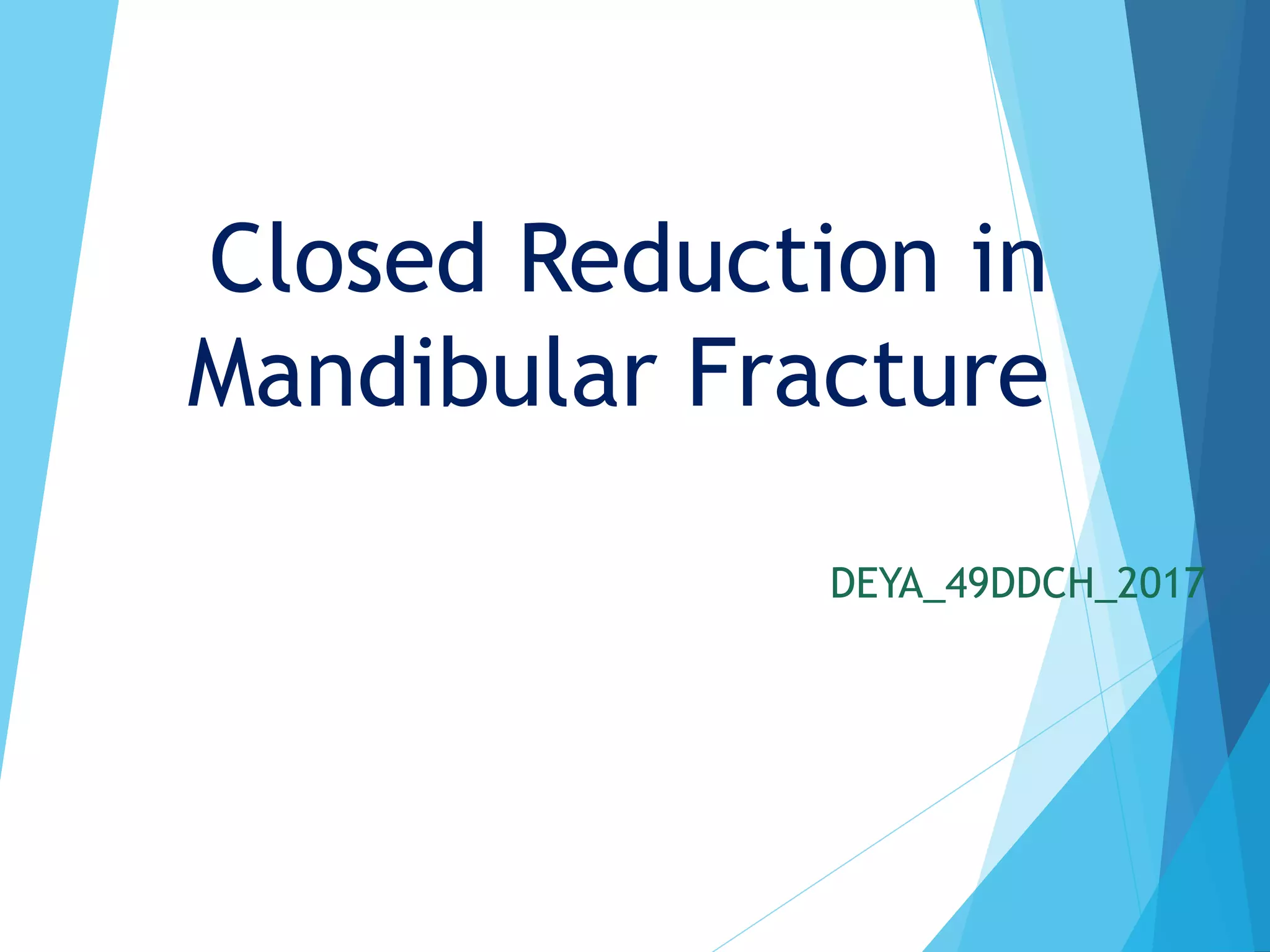 Closed Reduction in Mandibular Fractures | PPTX