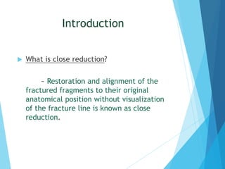 Closed Reduction in Mandibular Fractures | PPTX