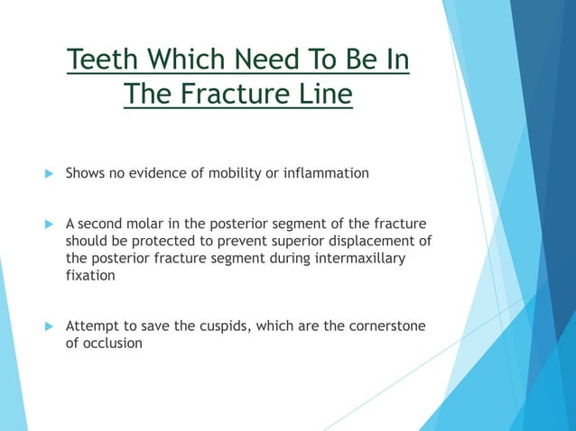 Closed Reduction in Mandibular Fractures