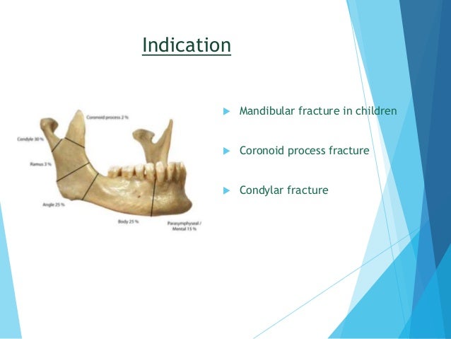 Closed Reduction in Mandibular Fractures
