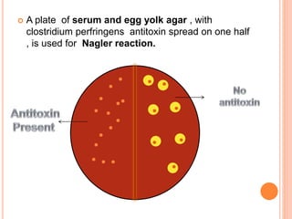 Clostidium perfringens | PPTX