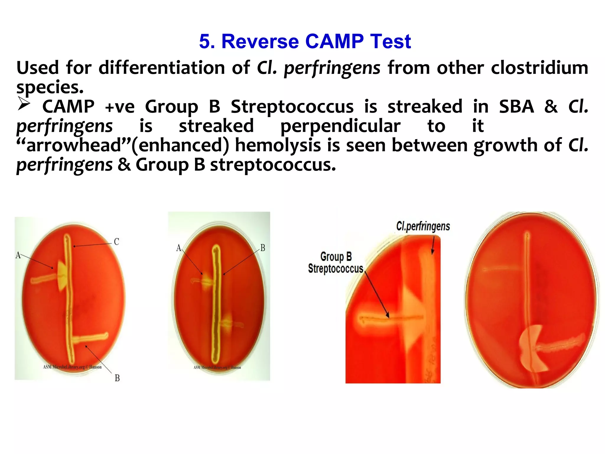 Clostridial toxins: Clostridium perfringens and Clostridium difficile | PPT