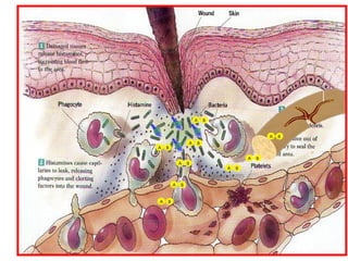 Tetanus Bacteria Diagram