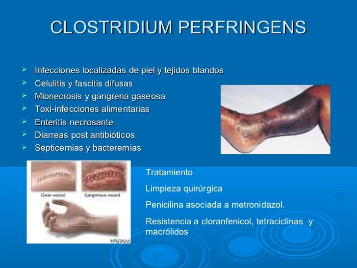 Clostridium