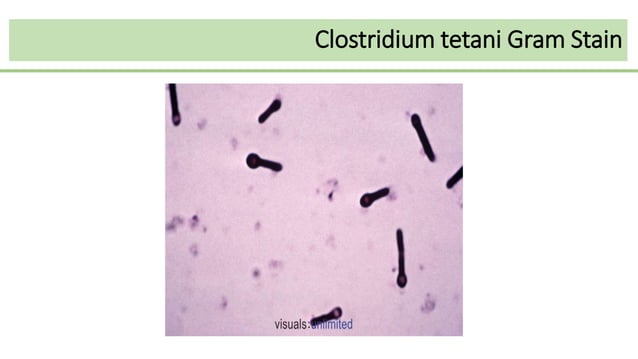 Spore-forming gram Positive bacteria | PPT