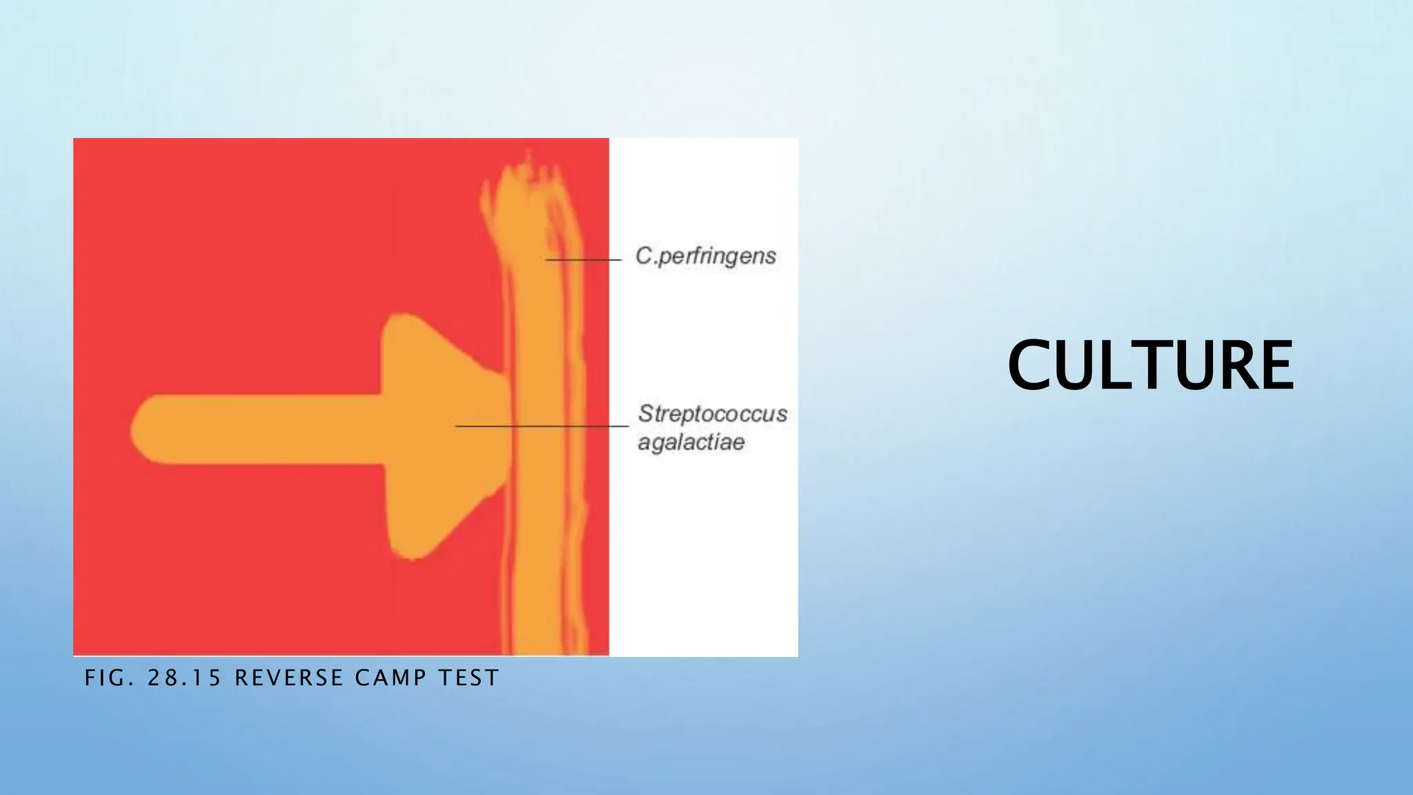 CLOSTRIDIUM and its laboratory diagnosis.pptx