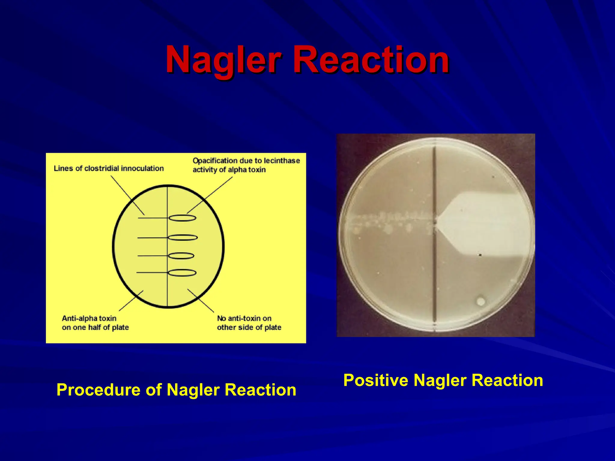 Bacteriology of Clostridium species in animals | PPT
