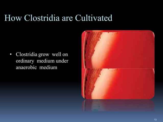 Clostridium species | PPTX