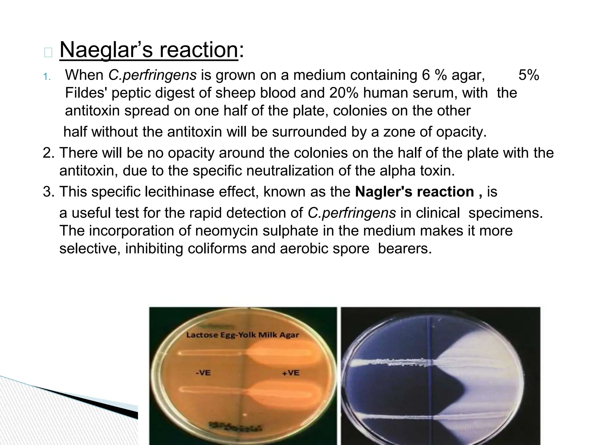 CLOSTRIDIUM and its pathogenesis in humans ppt. | PPTX