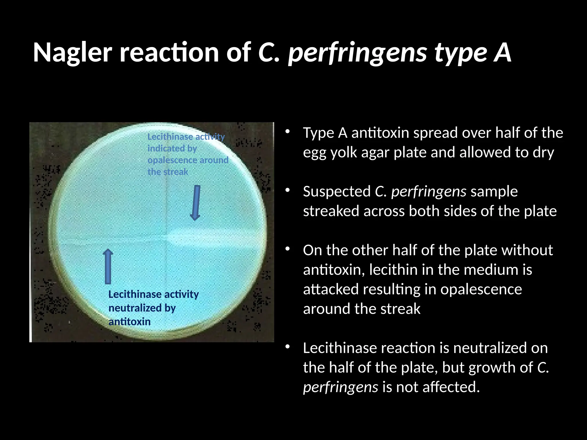 Clostridium ppt for undergraduate class | PPTX