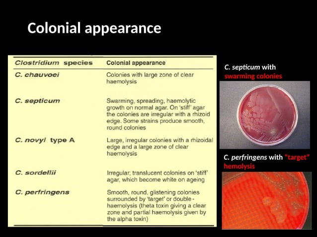 Clostridium ppt for undergraduate class | PPTX | Chemistry | Science