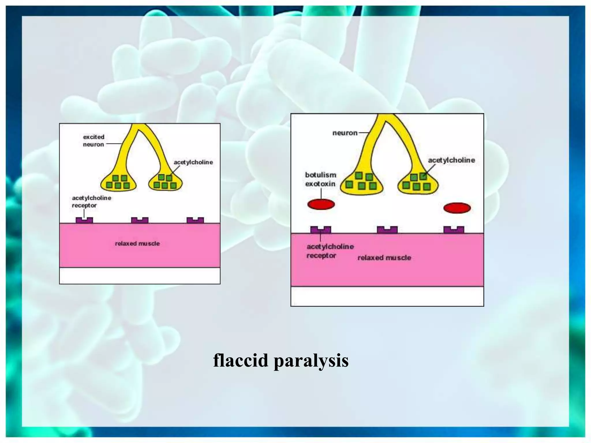 Clostridium botulinium(Microbiology) | PPTX | Digestive Disorders ...