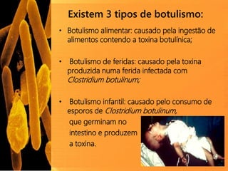 Clostridium botulinum | PDF