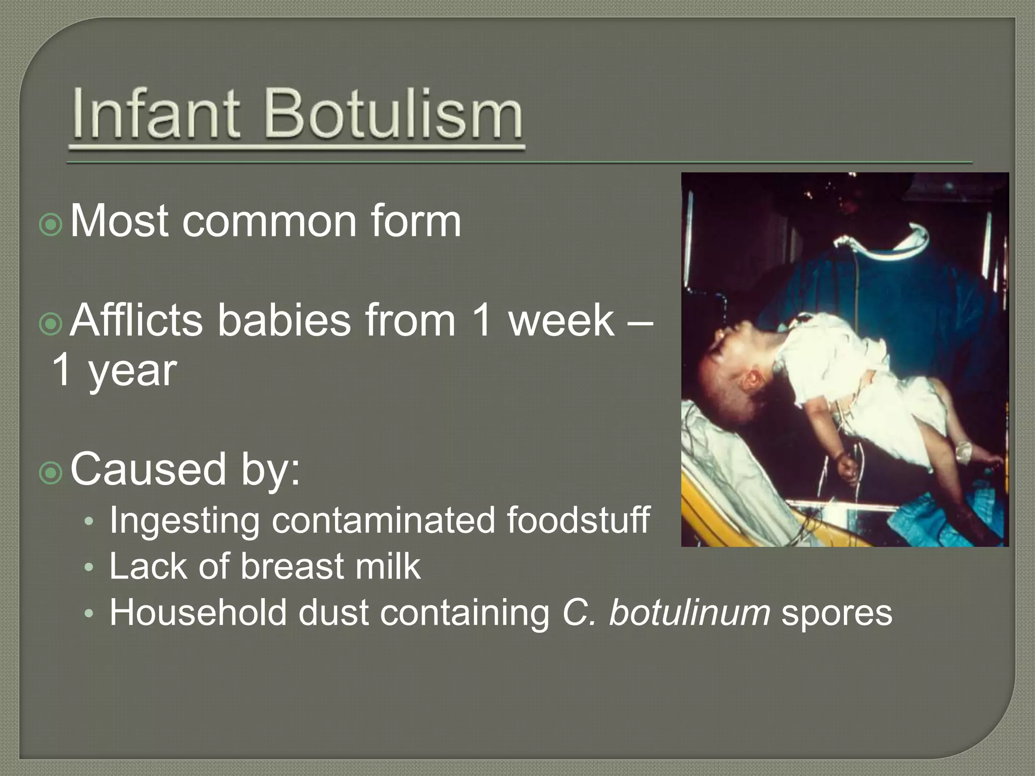 Clostridium botulinum | PPTX