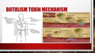 Clostridium botulinum | PPTX