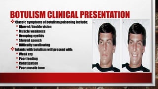 Clostridium botulinum.pdf