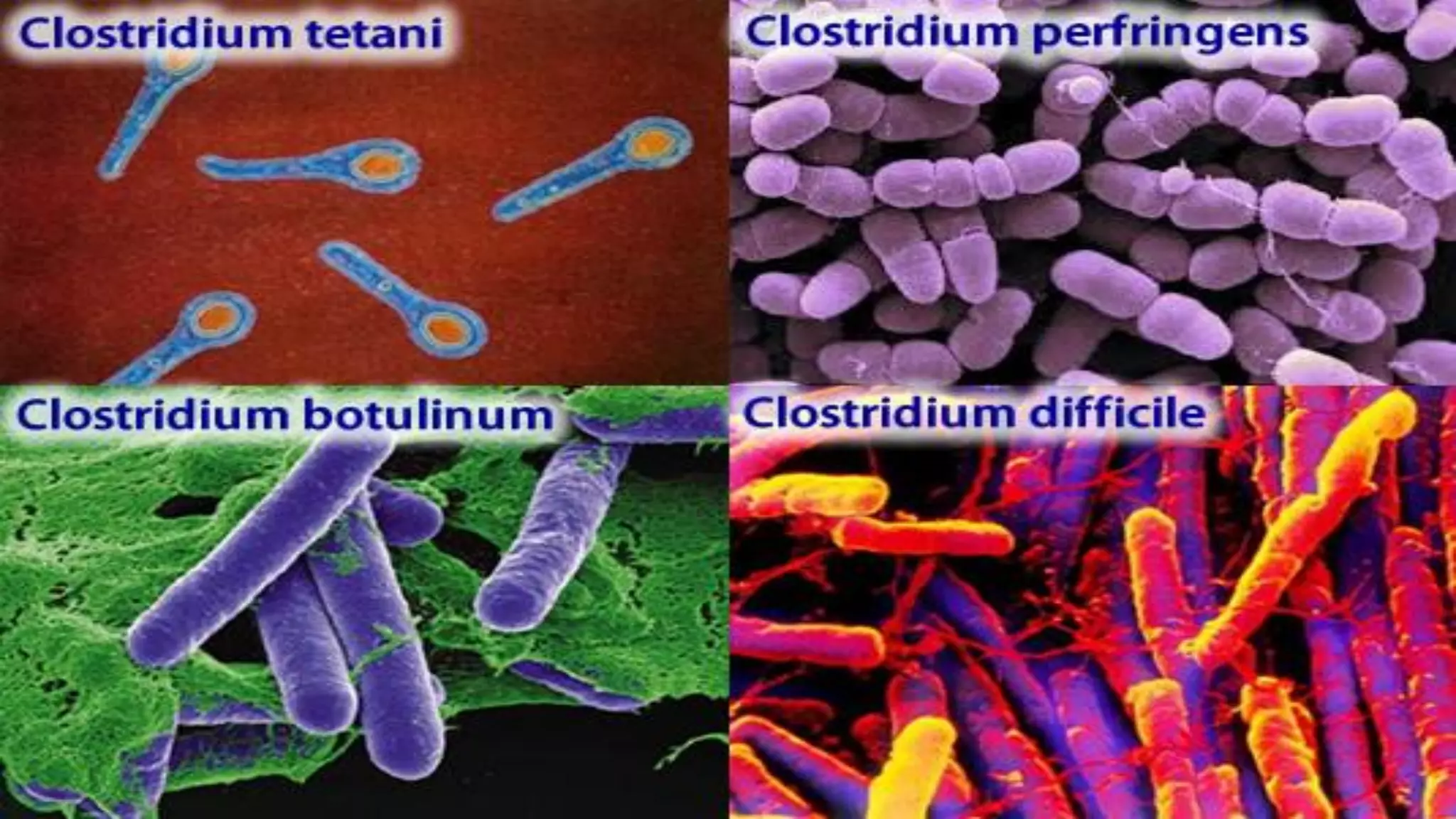 Clostridium clase teorica | PPT