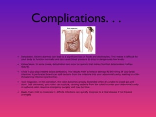 Clostridium Difficile | PPT