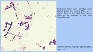 Clostridium Difficile Spore Stain