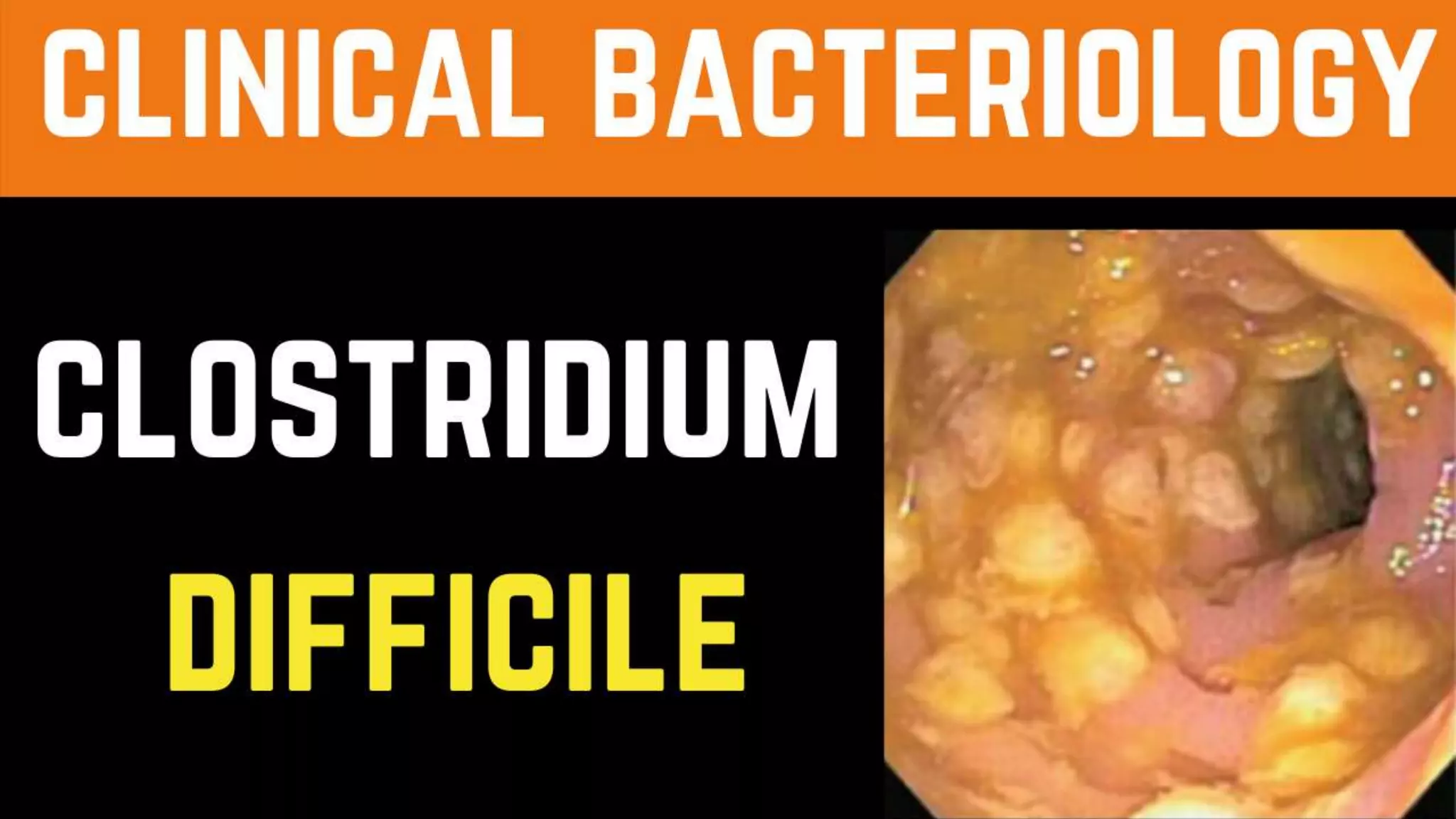 Clostridium Difficile Bacteria | Clinical Bacteriology | Microbiology ...