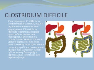 CLOSTRIDIUM DIFFICILE.pptx