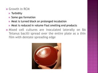 Clostridium i (1) | PPTX