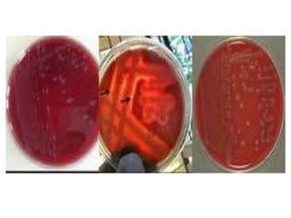 power point presentation of clostridium perfringens for health care ...