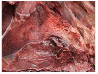 power point presentation of clostridium perfringens for health care ...