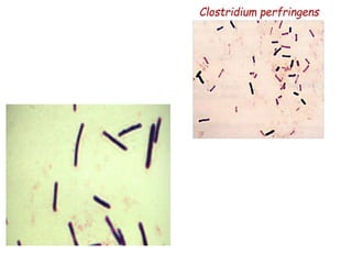 power point presentation of clostridium perfringens for health care ...
