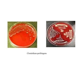 power point presentation of clostridium perfringens for health care ...