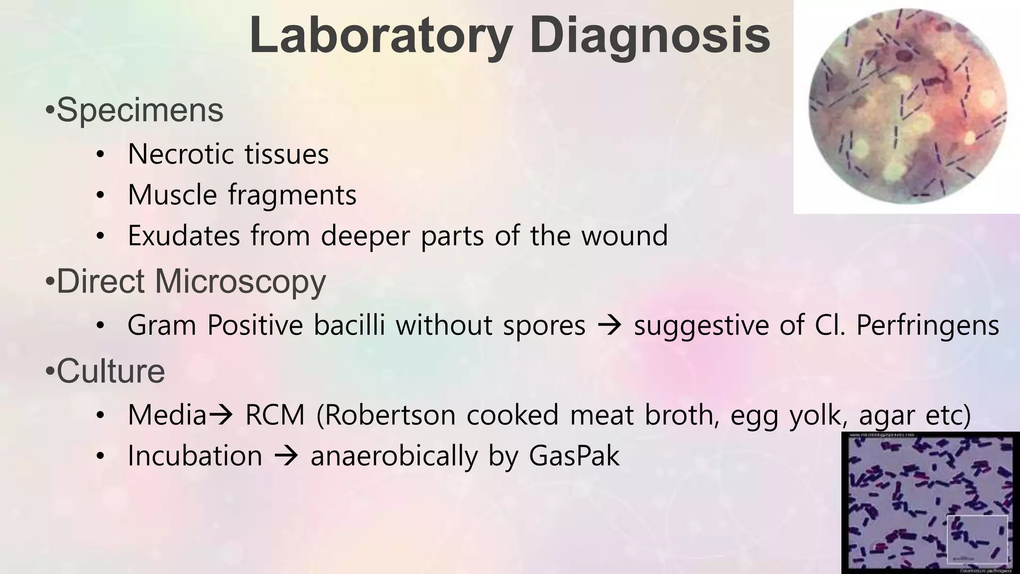 Clostridium perfringens | PPTX
