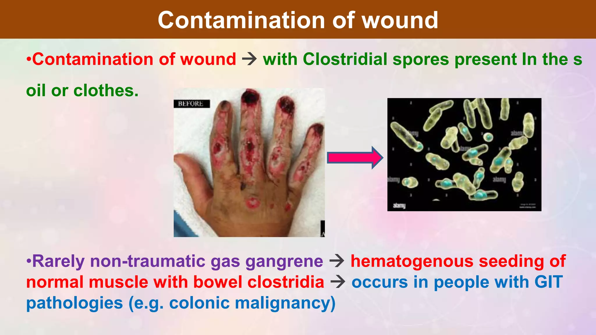 Clostridium perfringens.pptx