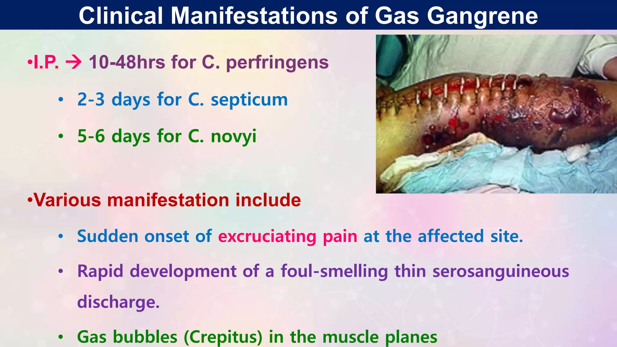 Clostridium perfringens.pptx