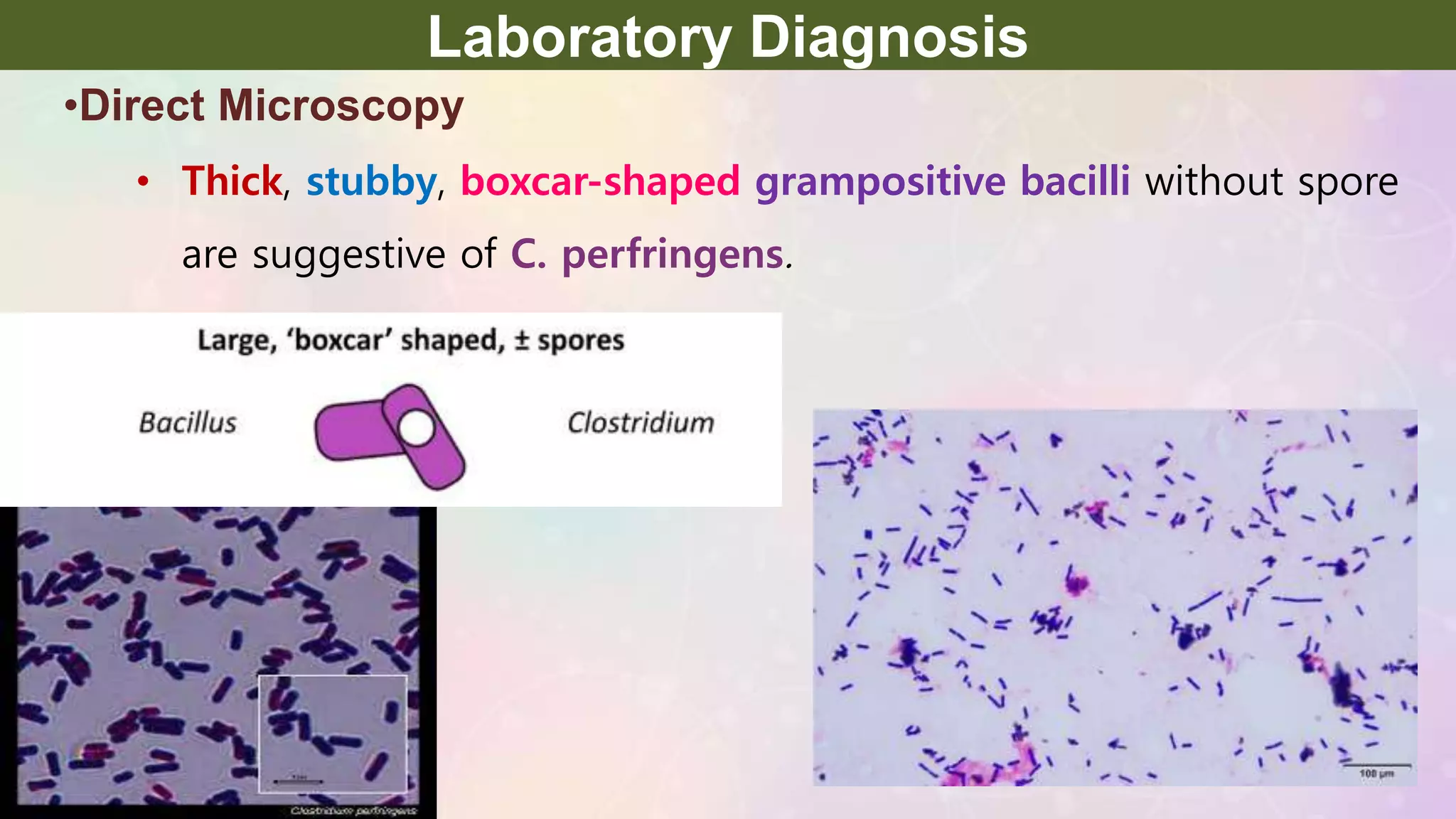 Clostridium perfringens.pptx