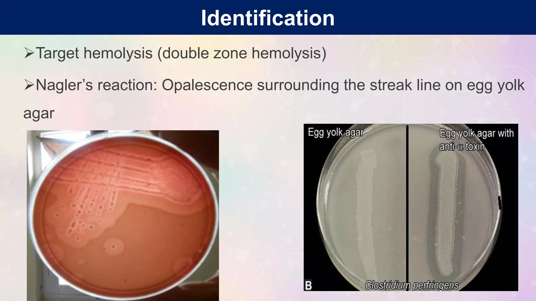 Clostridium perfringens.pptx