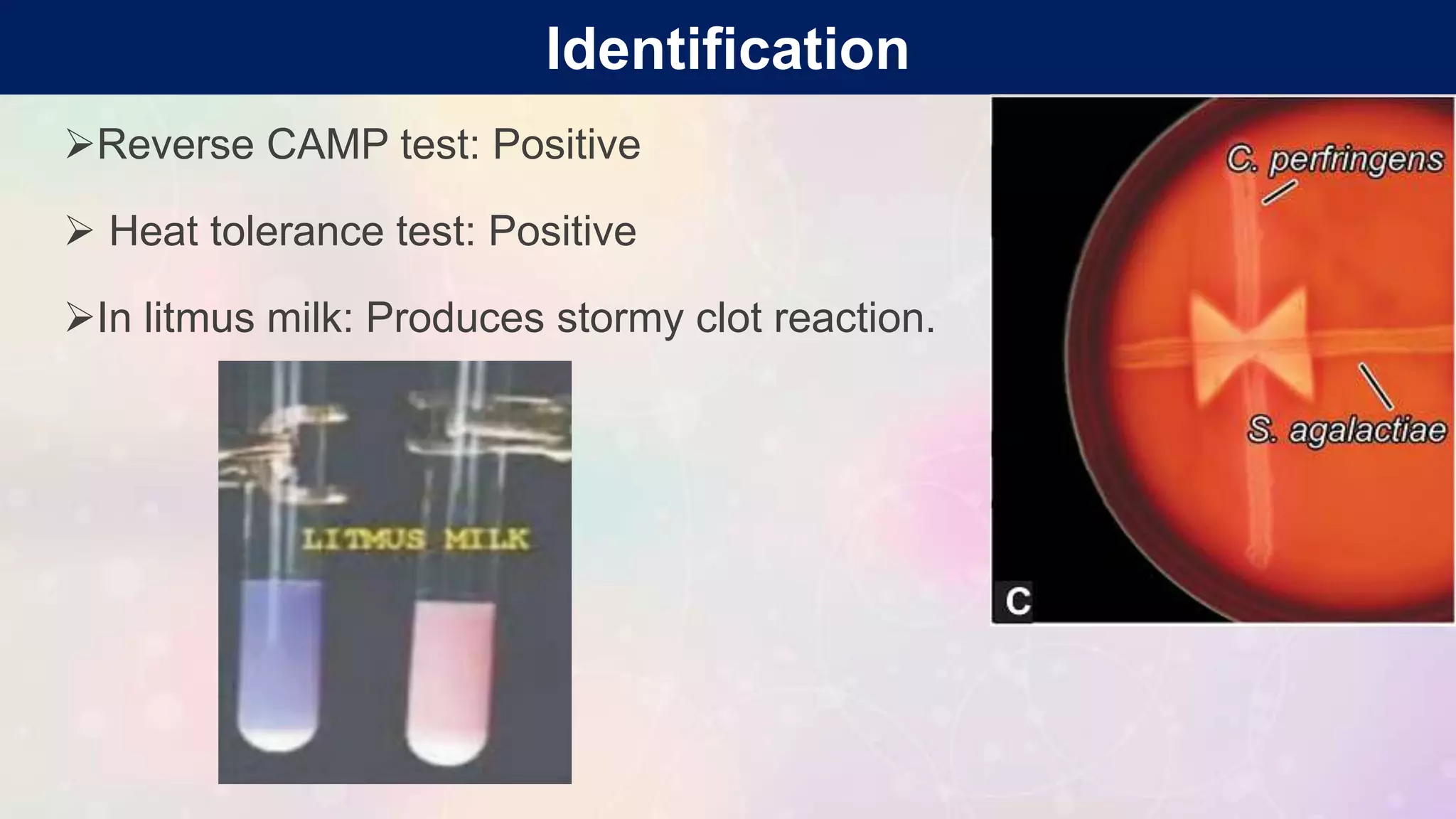 Clostridium perfringens.pptx