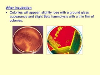 Clostridium microbacteria | PPT