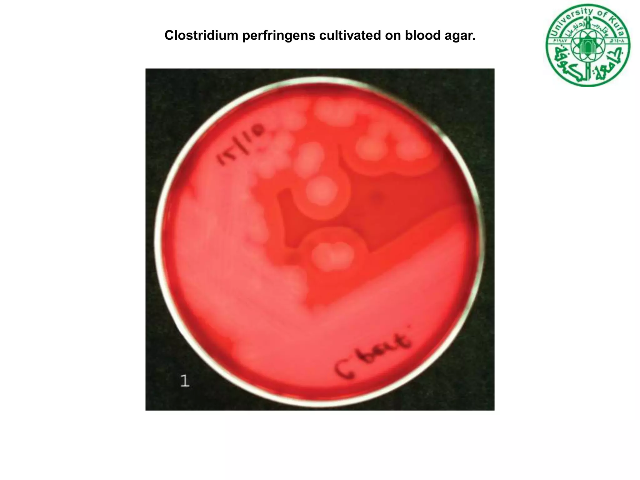 Veterinary important Clostridium species | PPTX