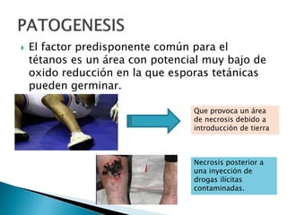 Clostridium tetani | PPTX