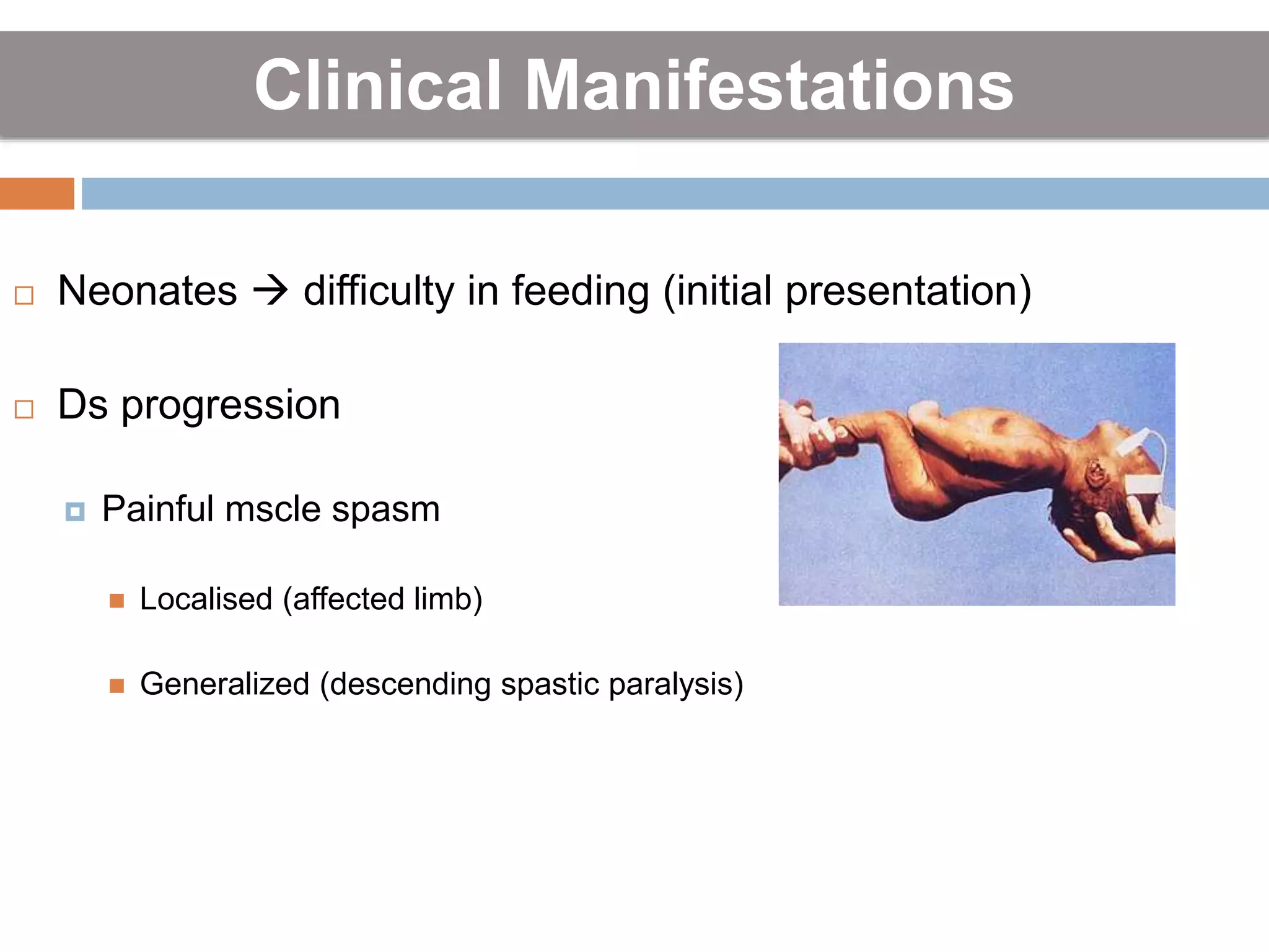 Clostridium tetani.pptx