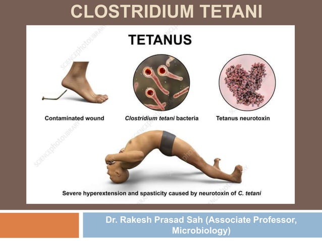 Clostridium tetani.pptx | Infectious Diseases | Diseases and Conditions