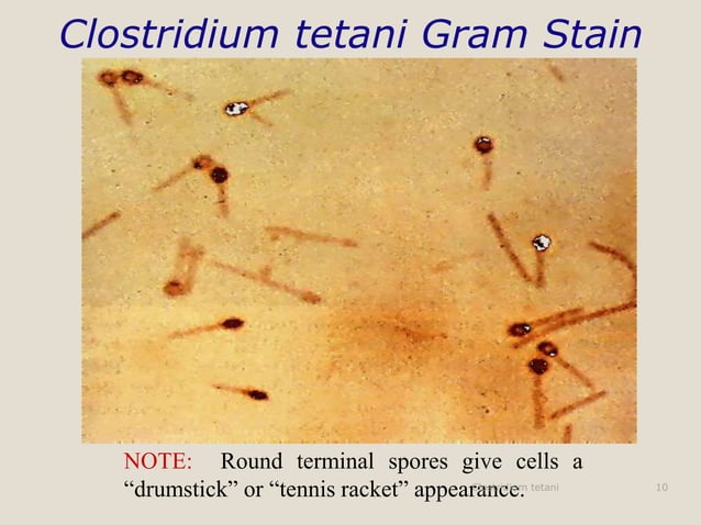 CLOSTRIDIUM TETANI FINAL - Copy.pptx